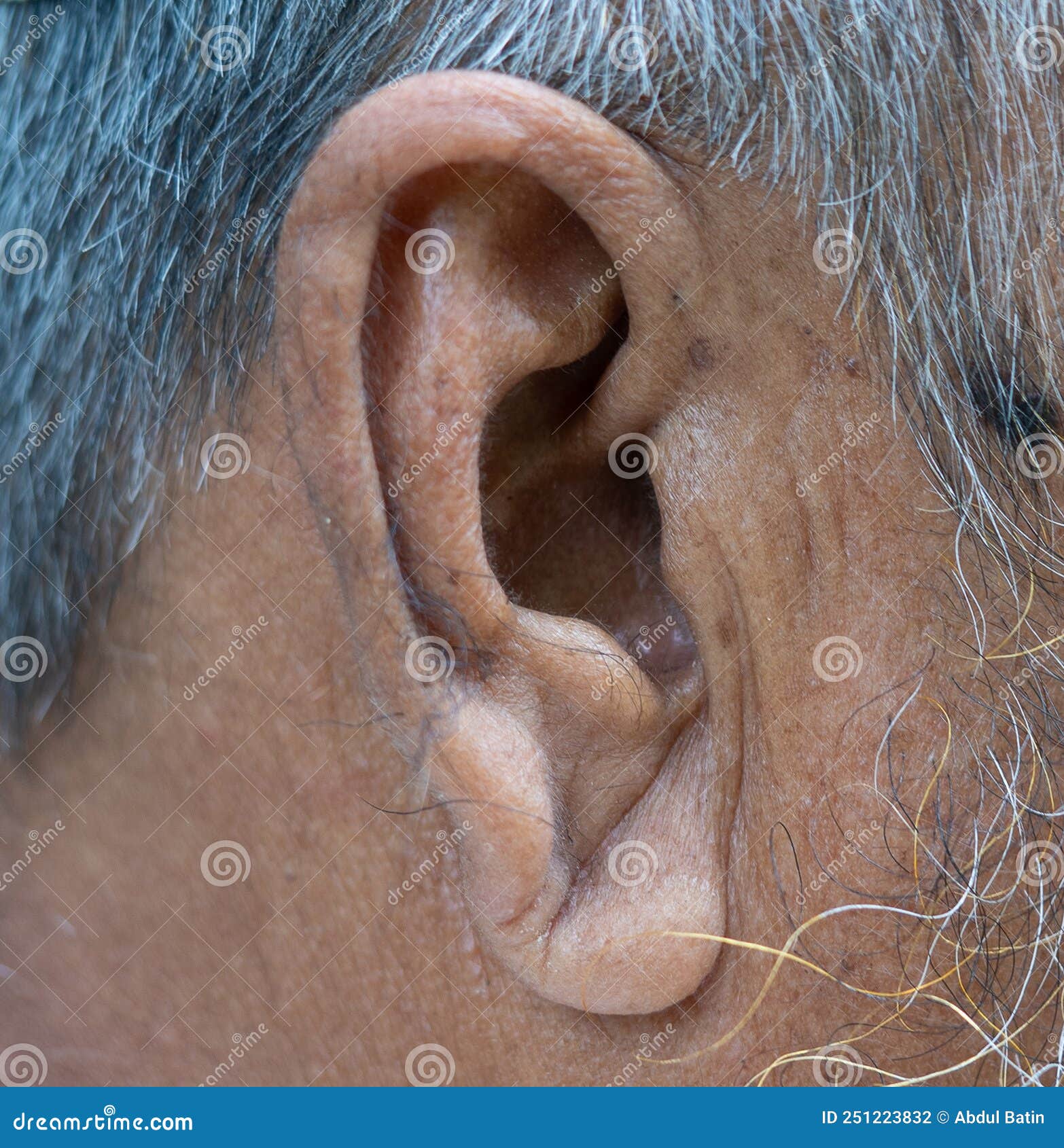 Old Senior Man Ear Close-up Macro Shot Stock Photo - Image of brown ...