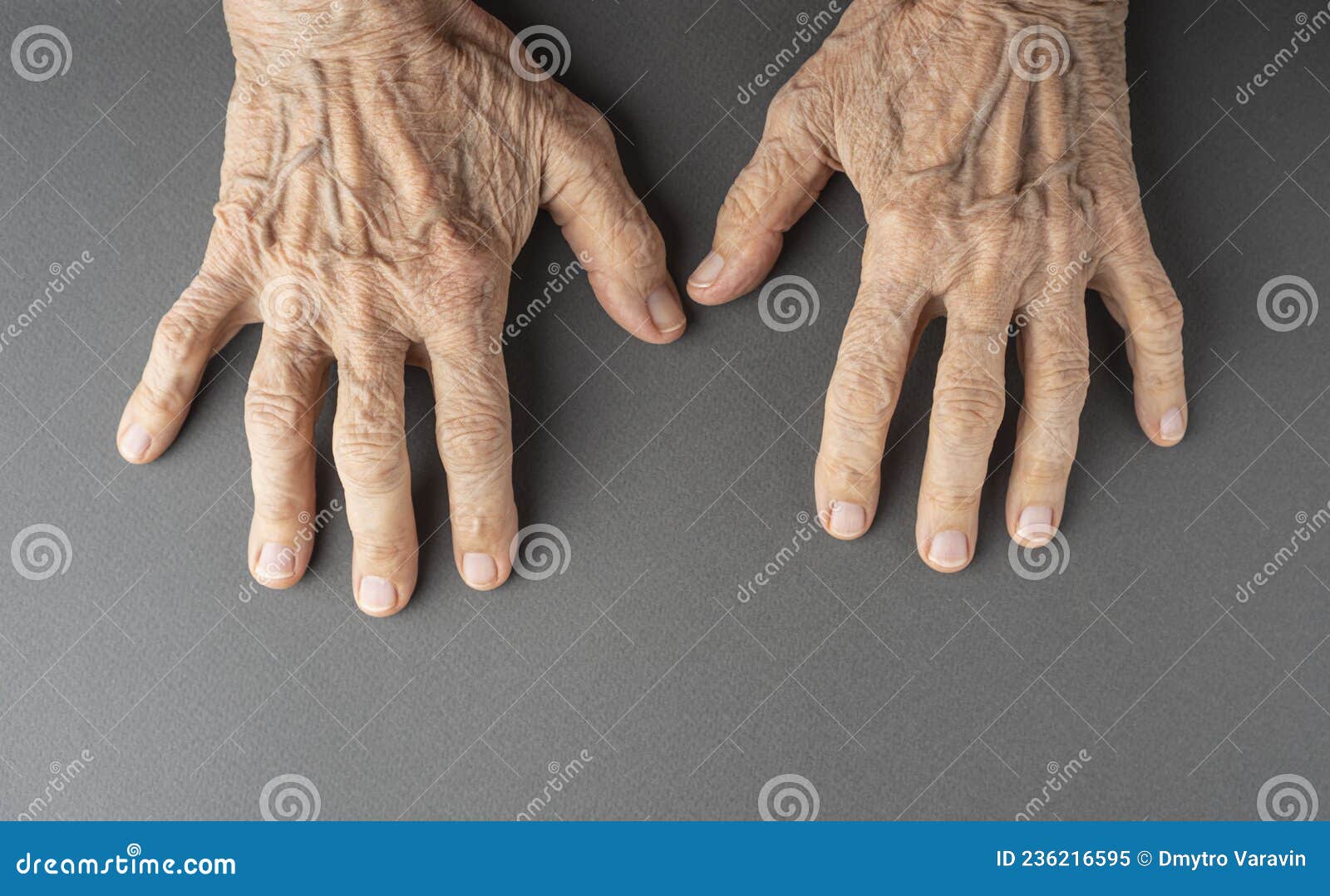 Old Wrinkled Hands with Veins Stock Image - Image of person, assistance ...