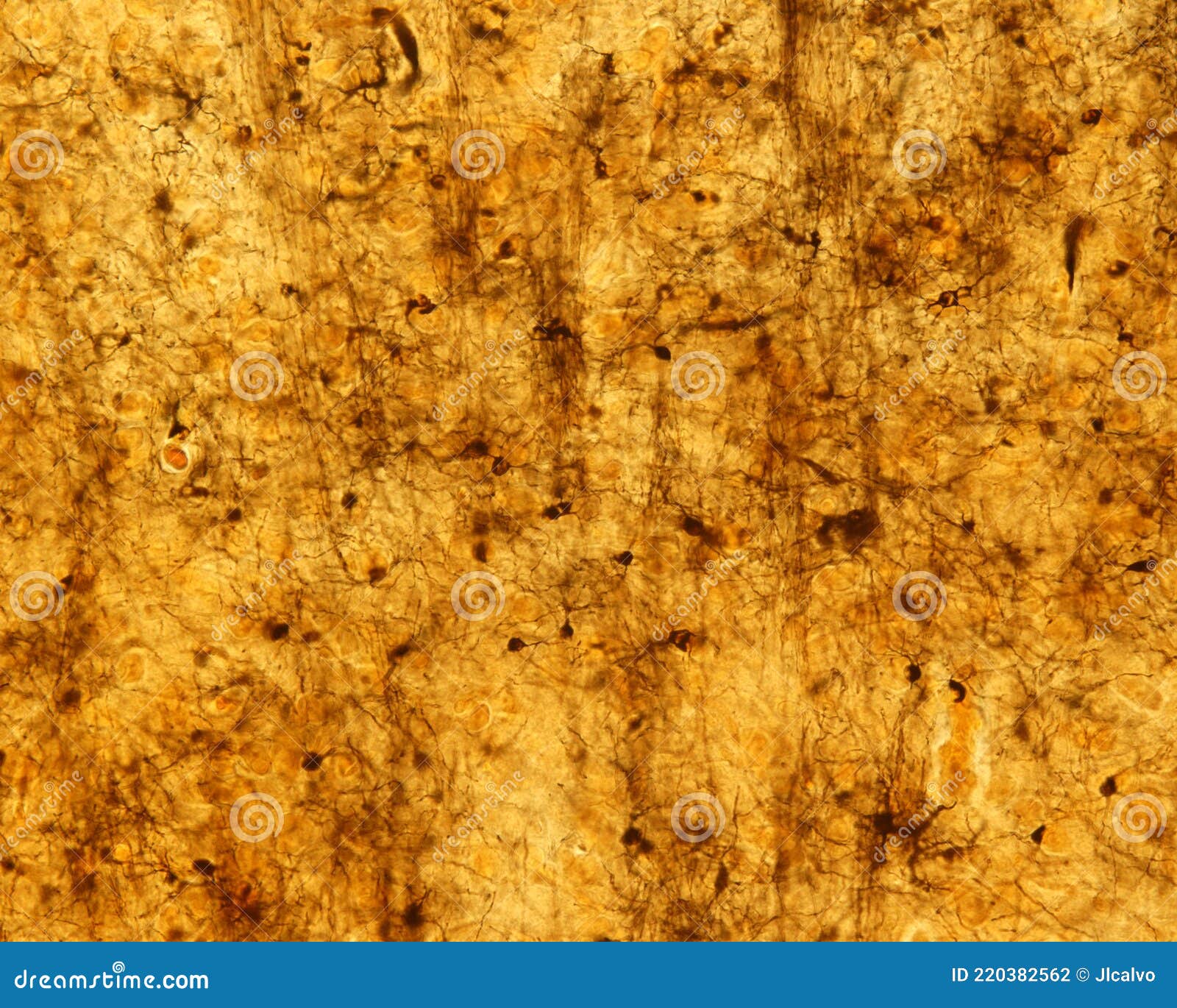 Oligodendroglia Cells. Silver Chromate Stock Photo - Image of ...