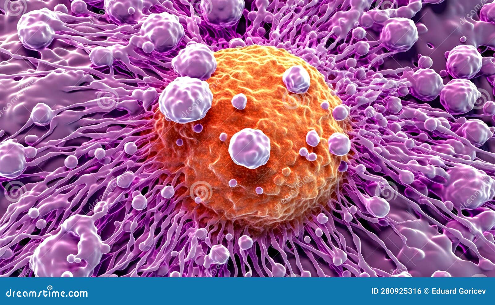 Oncology, Cancerous Cell in Biological Tissue Under a Microscope Made ...