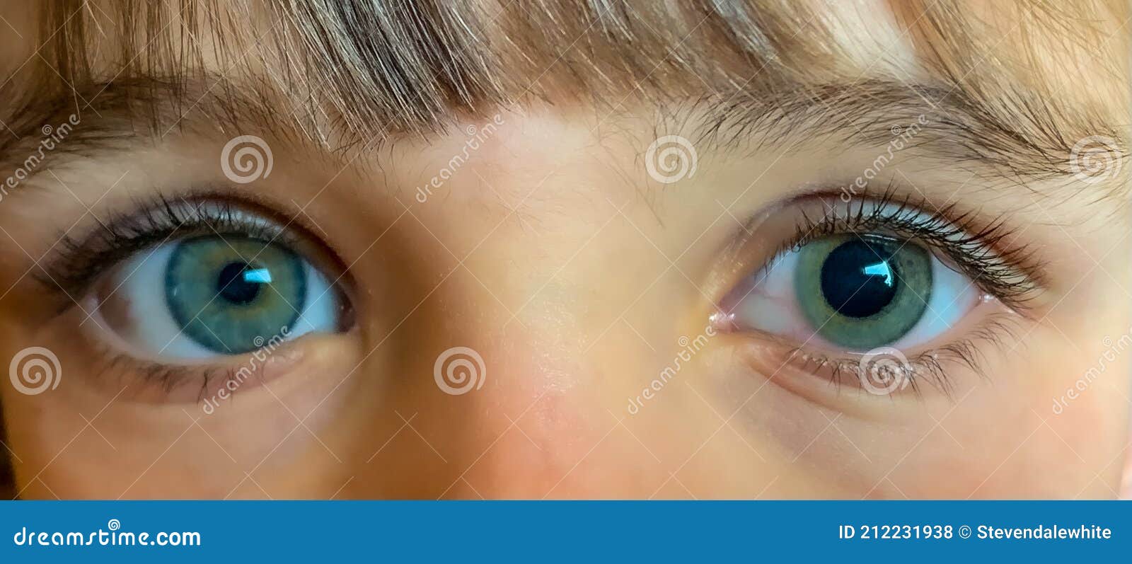 Constricted Pupils And Altered Mental Status