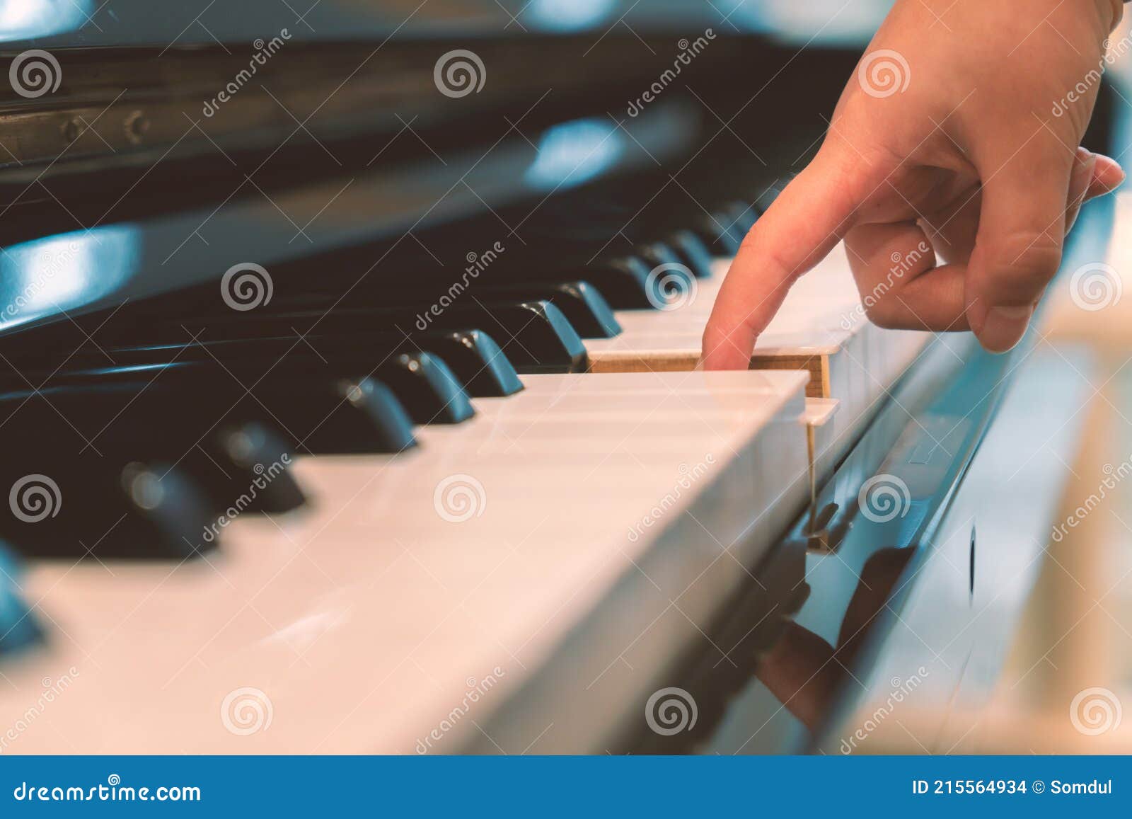 Finger Of A Child`s Hand Is Bent In The Upper First Phalanx Of The ...