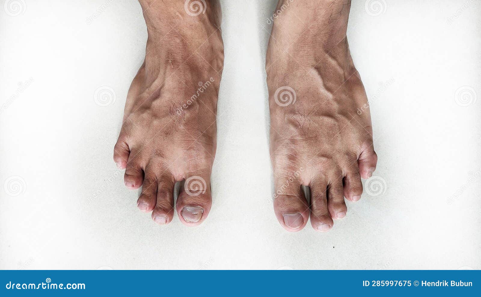 One form of worker foot stock image. Image of muscle - 285997675