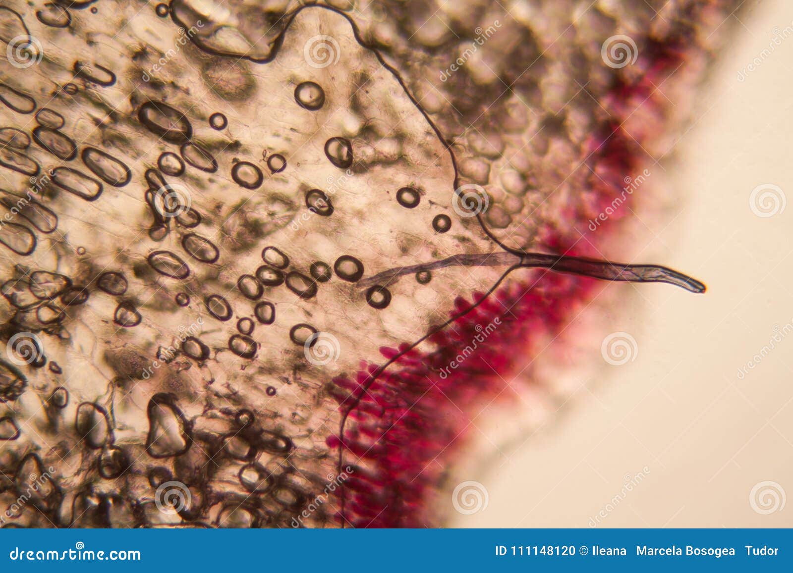 Onion Cells at the Microscope Stock Photo - Image of dividing, haploid ...