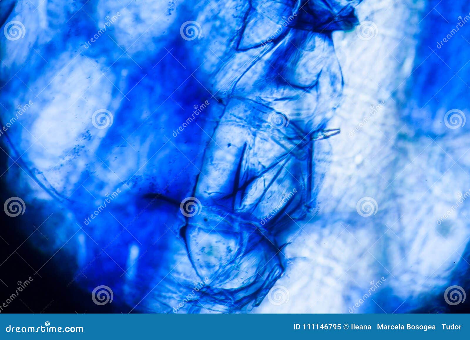 Metaphase Of An Onion Root Tip Cell Under The Microscope Royalty-Free ...