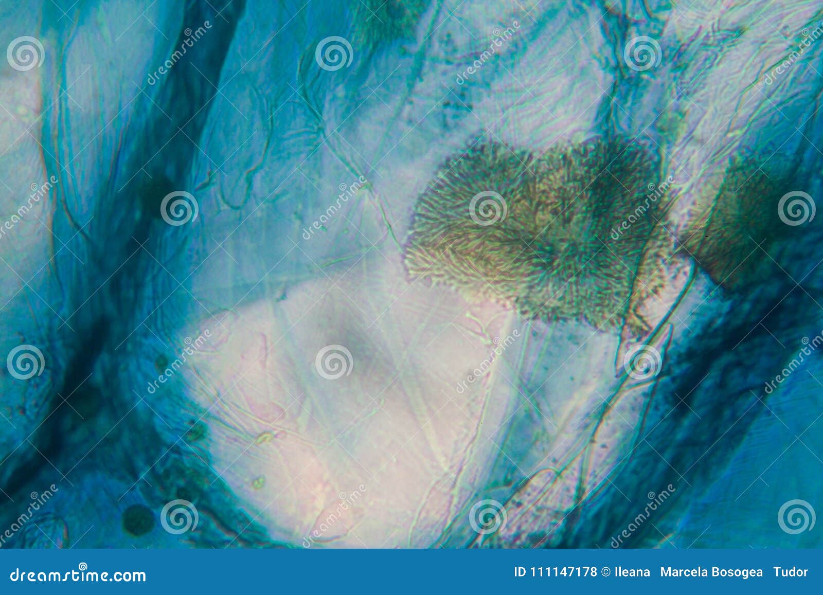 Onion Cells at the Microscope Stock Photo - Image of chromosome ...