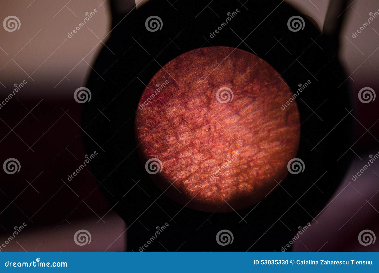 Cells Of An Onion Root Tip Undergo Mitosis. Anaphases And Metaphases ...