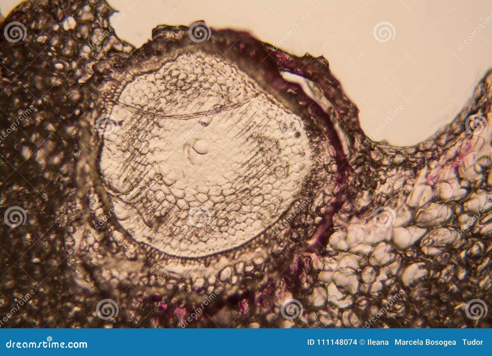 Onion Root Cells at the Microscope Stock Photo - Image of nucleus ...