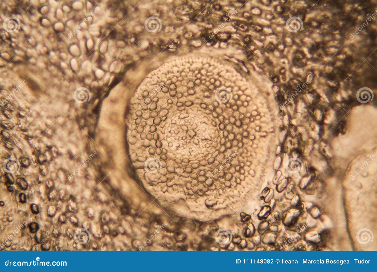 Cells Of An Onion Root Tip Undergo Mitosis. Anaphases And Metaphases ...