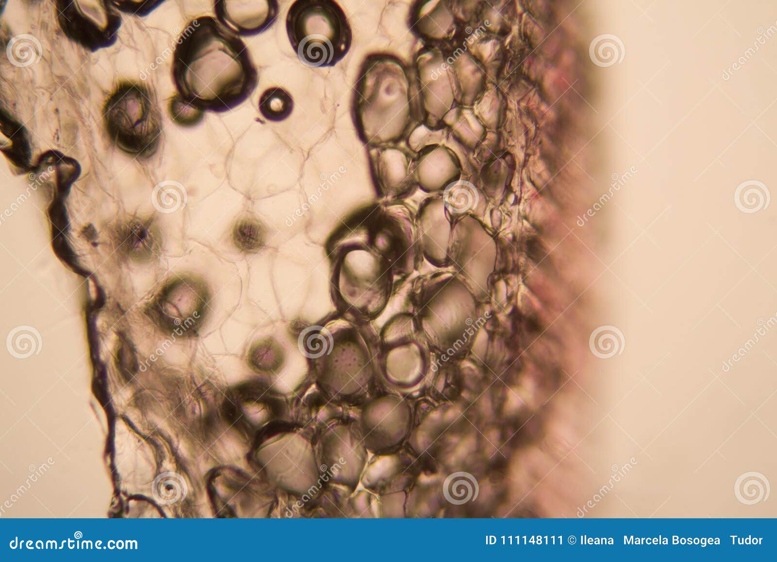 Onion Root Cells at the Microscope Stock Image - Image of interphase ...