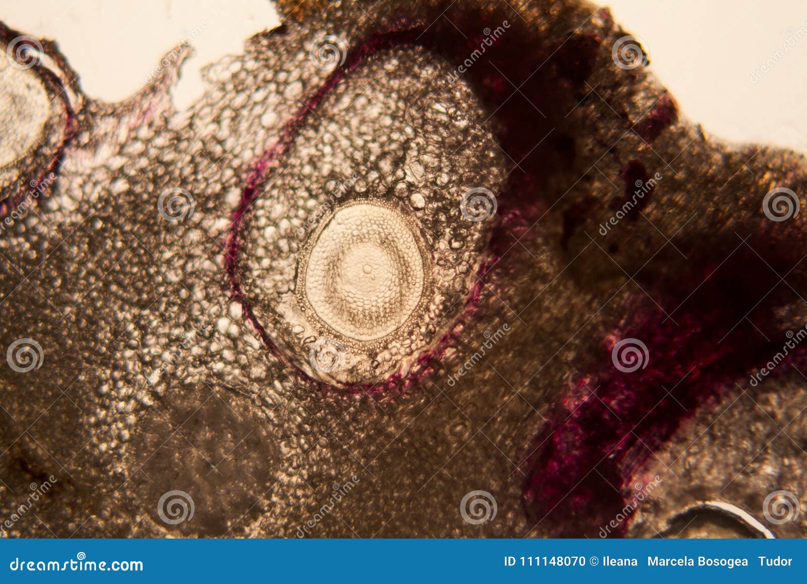 Onion Root Cells at the Microscope Stock Photo - Image of cells ...