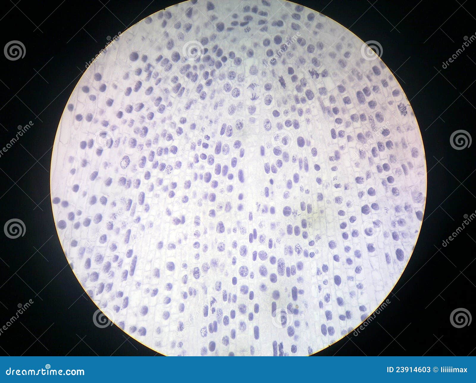 Cells Of An Onion Root Tip Undergo Mitosis. Anaphases And Metaphases ...