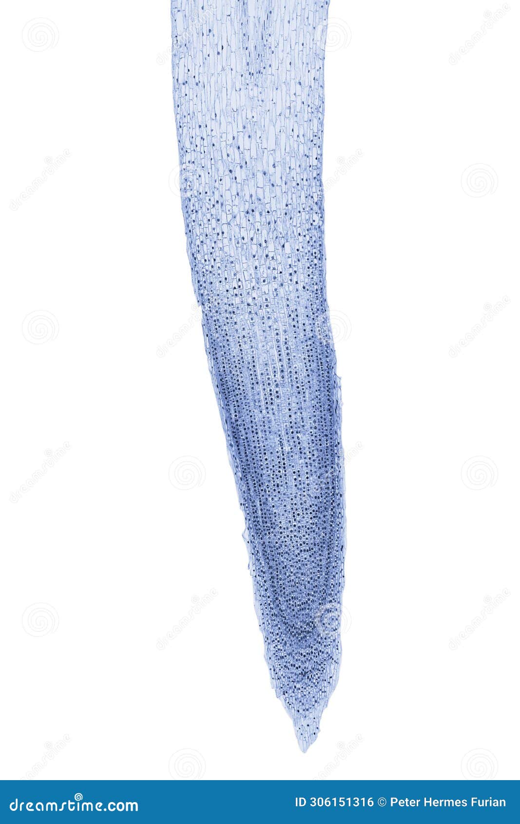 Onion Root Tip, Allium Cepa, Showing Mitosis, L.S., 20X Light ...