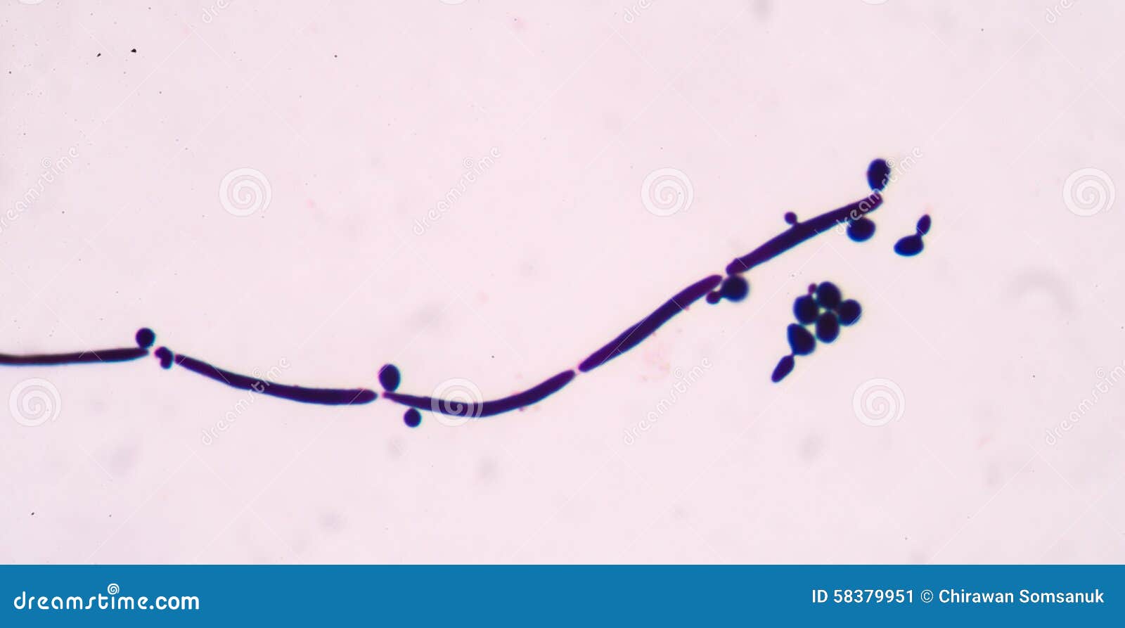 Ontluikende Gistcellen Met Pseudohyphae Stock Afbeelding - Image of ...
