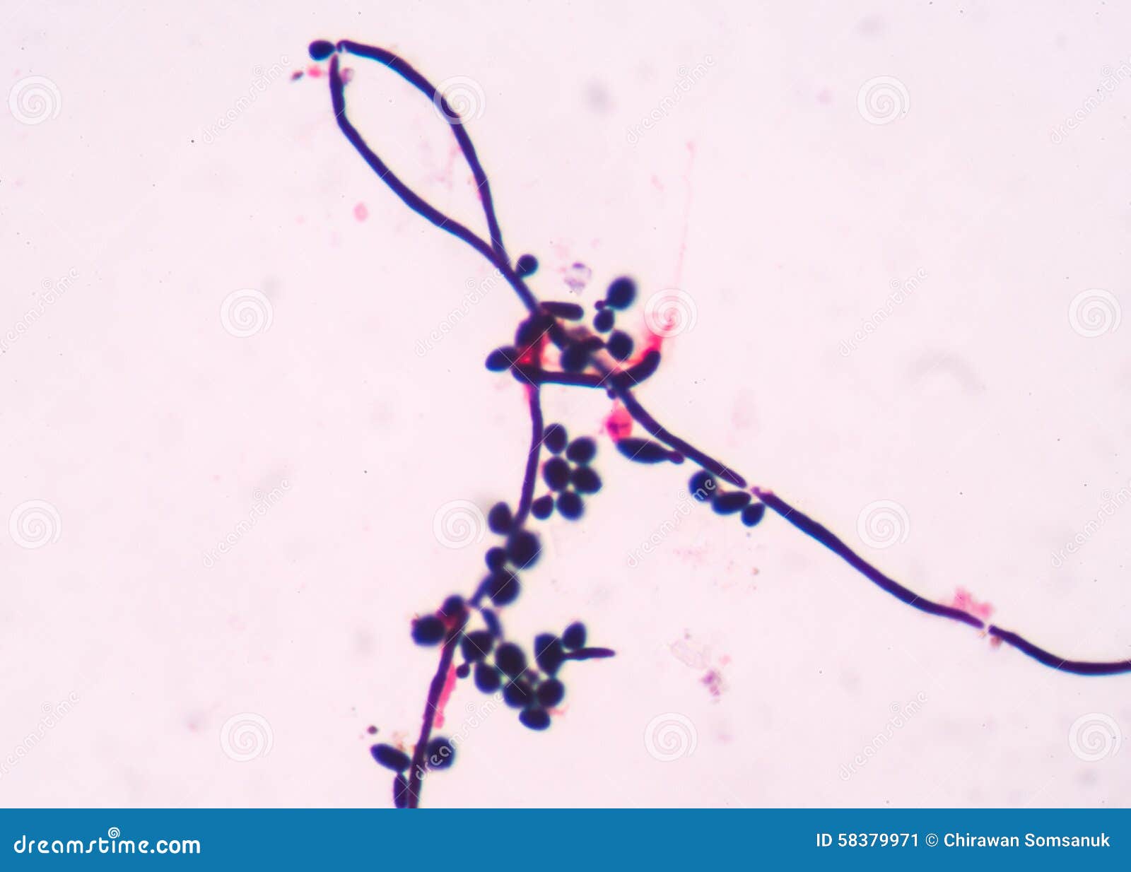 Ontluikende Gistcellen Met Pseudohyphae Stock Afbeelding - Image of ...