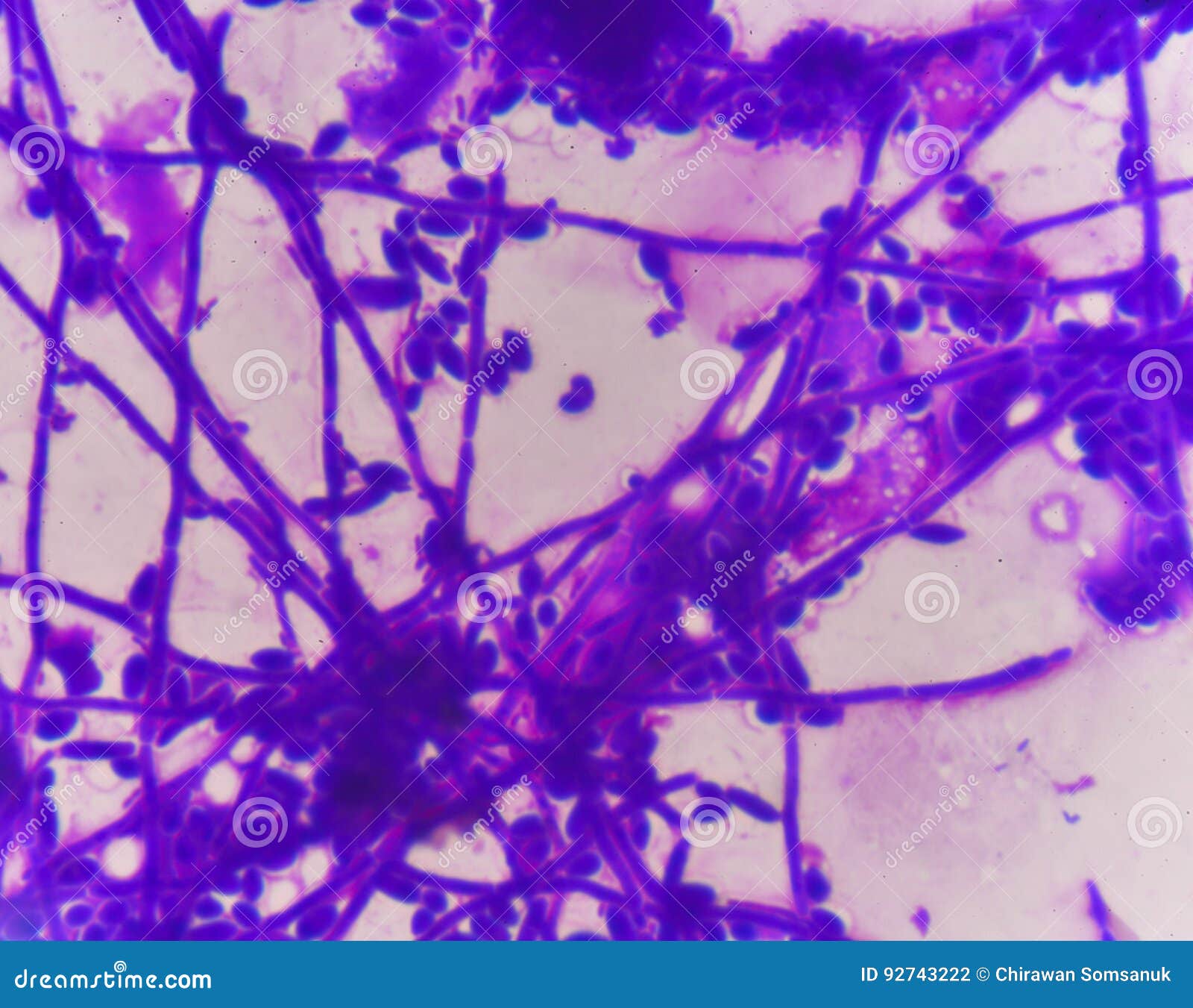 Ontluikende Gistcellen Met Pseudohyphae Stock Foto - Image of ...