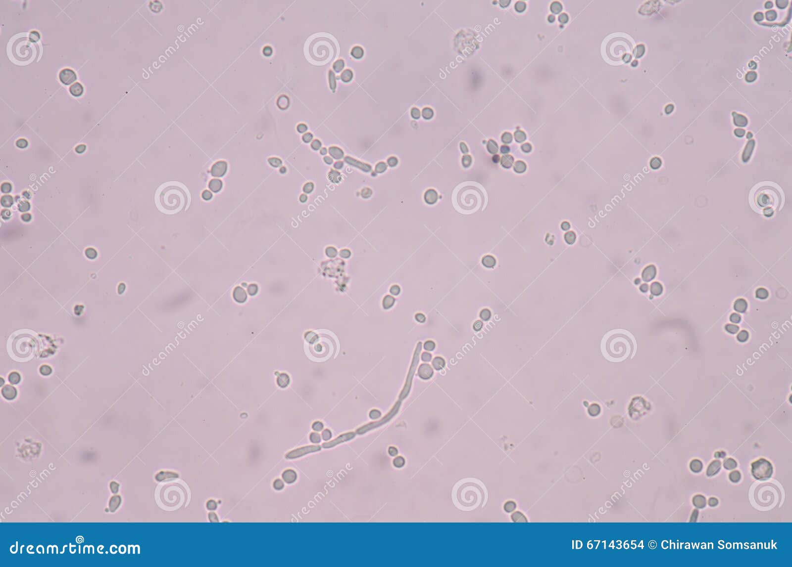 Ontluikende Gistcellen Met Pseudohyphae in Urinesteekproef Stock Foto ...