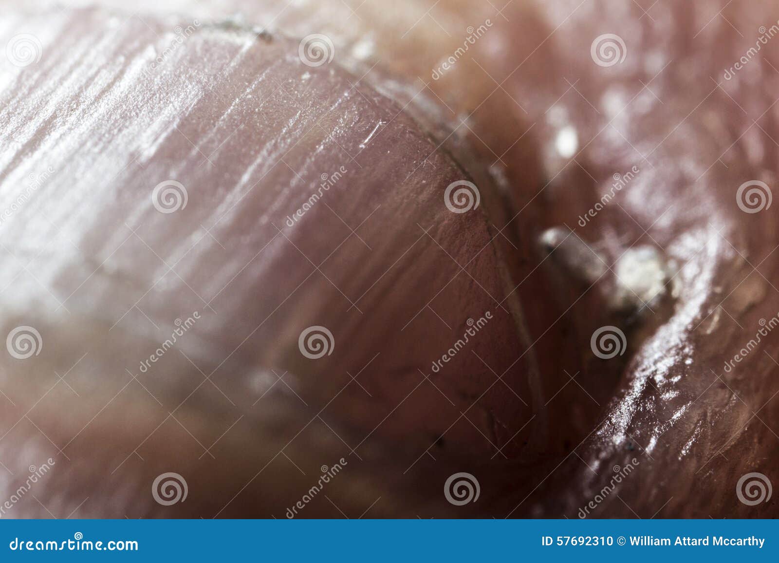 Onychophagy stock photo. Image of macro, excoriation - 57692310