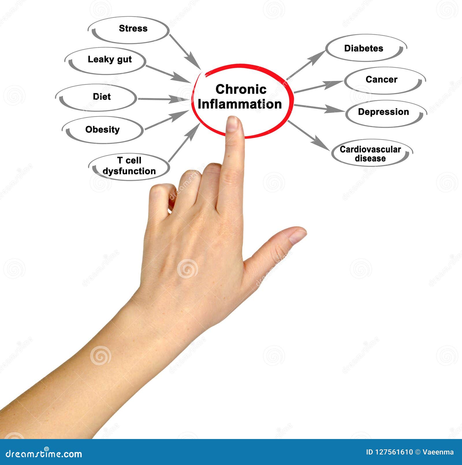 Oorzaken Van Chronische Ontsteking Stock Foto - Image of vinger, scherm ...