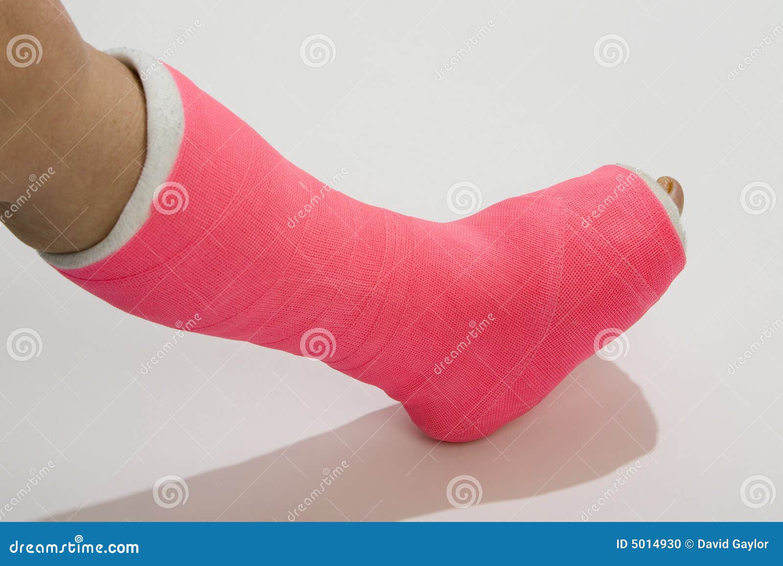 Open ad space on pink cast stock photo. Image of bandage - 5014930