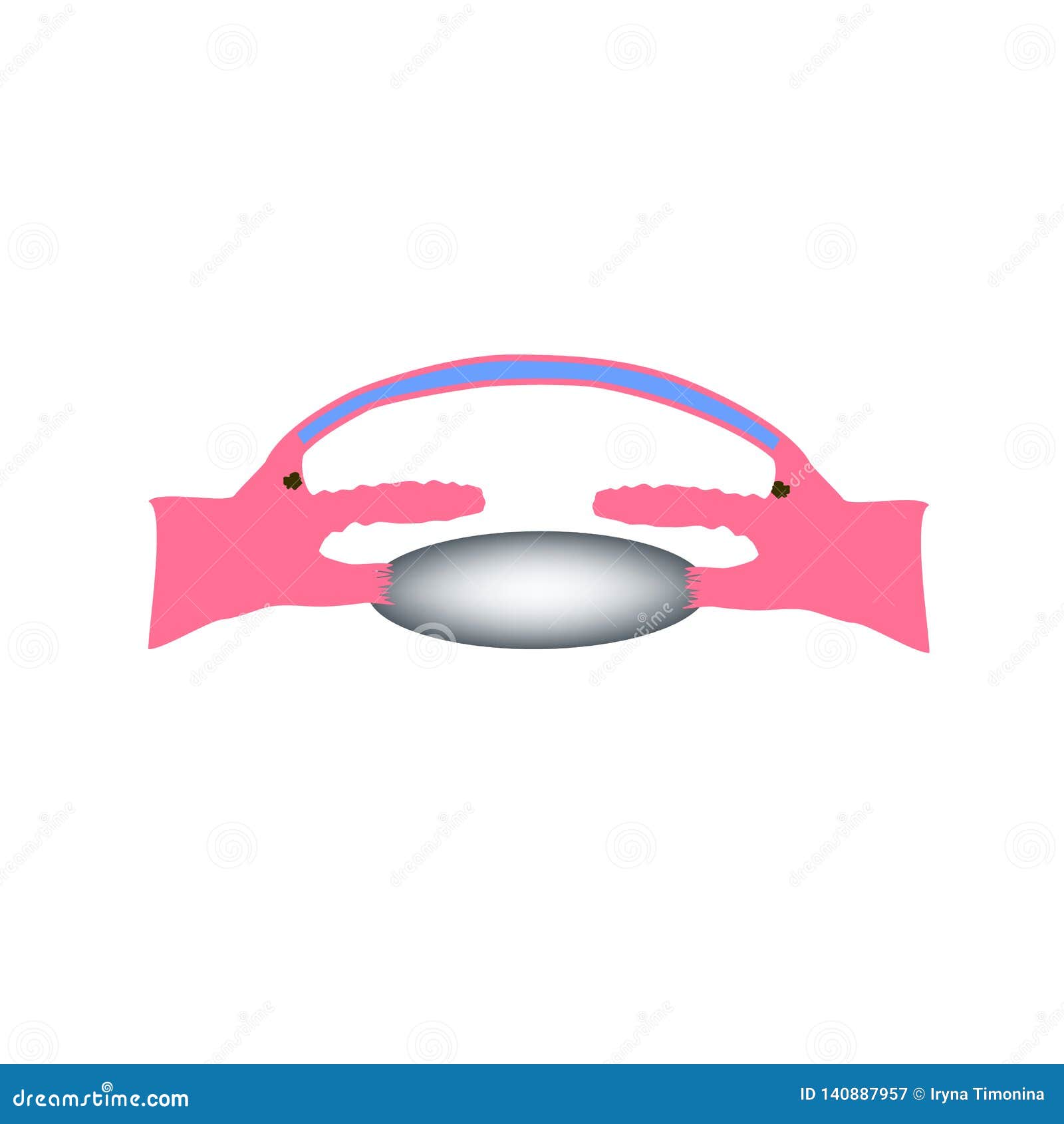 Open-angle Glaucoma. A Common Type Of Glaucoma. The Anatomical ... Open-angle Glaucoma. A Common Type Of Glaucoma. The Anatomical ...