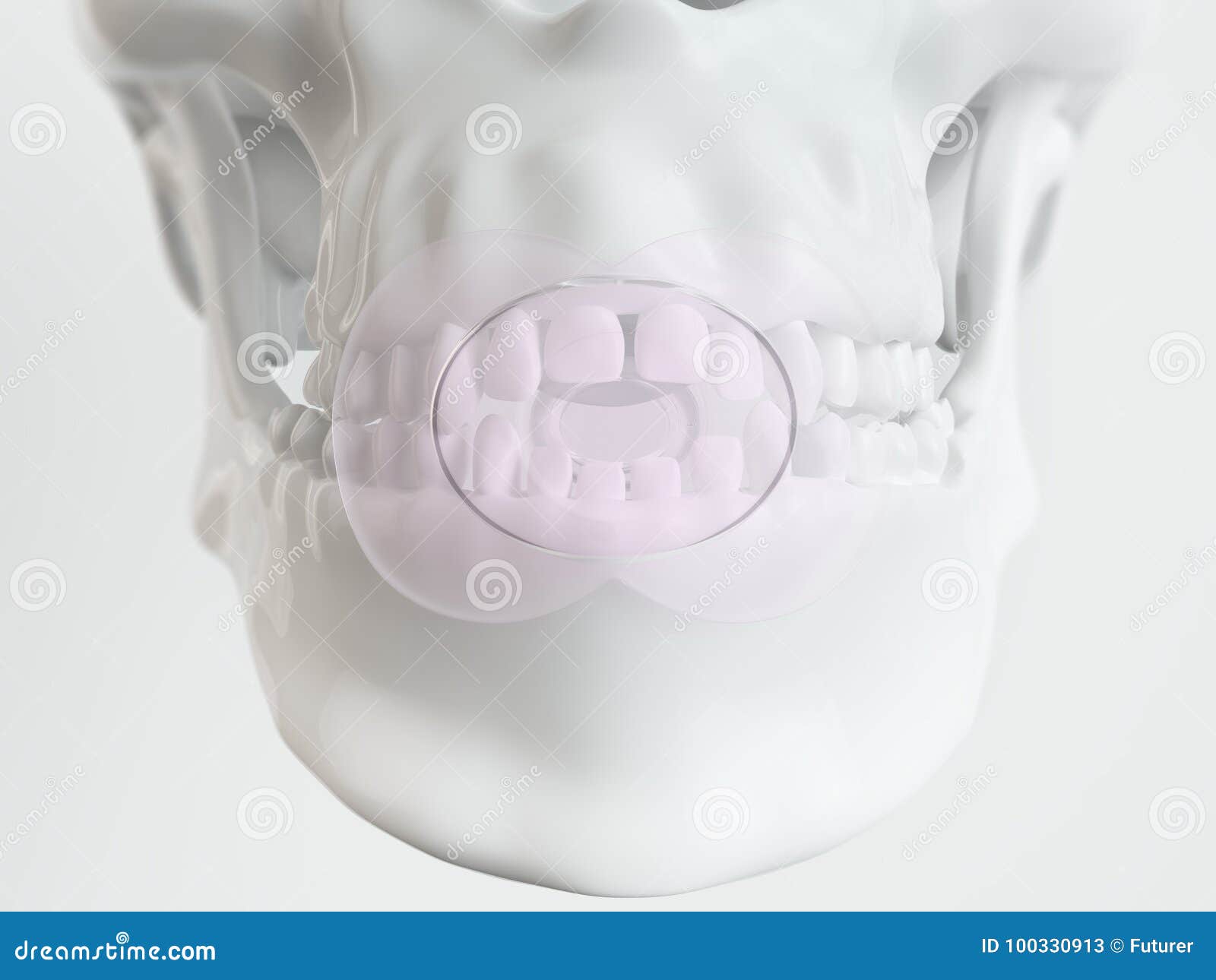 Open Bite By Pacifiers - 3D Rendering Royalty-Free Stock Image ...