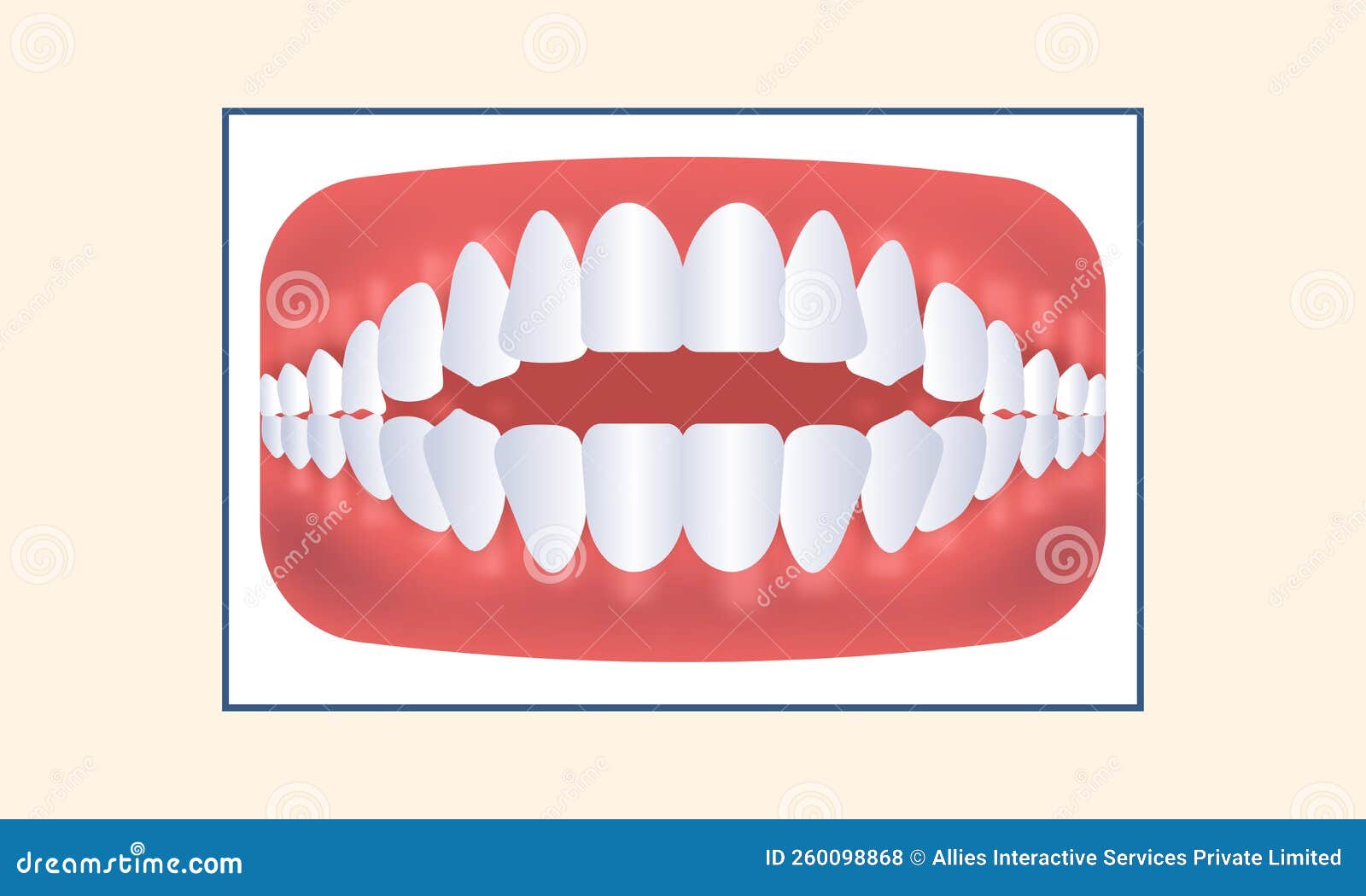 Open Bite Teeth Icon Against Yellow Stock Illustration - Illustration ...