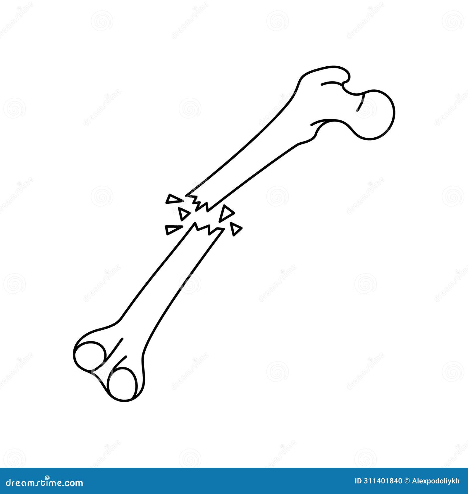 Oblique Displaced Bone Fracture Line Icon. Cartoon Vector ...