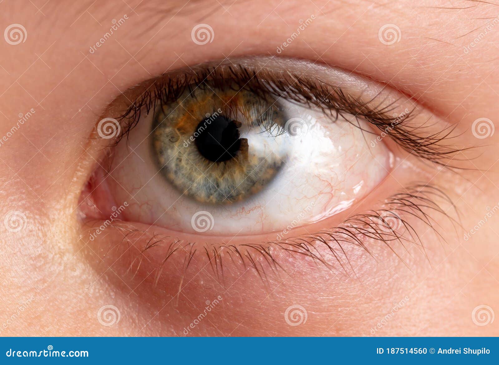 An Open Eye on the Boy’s Face Stock Photo - Image of vision, face ...