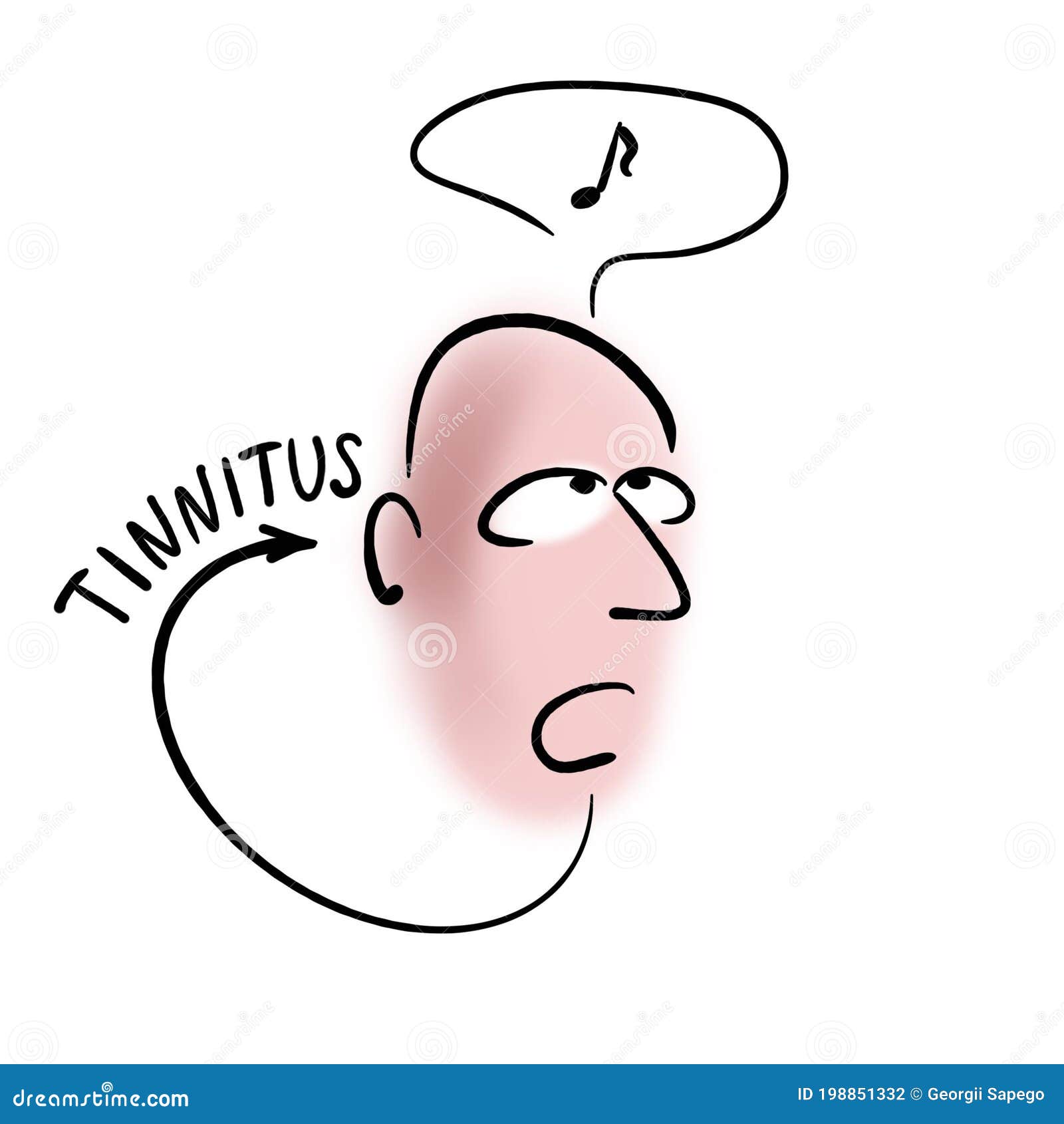 Open Mouth and Tinnitus in the Head Stock Illustration - Illustration ...