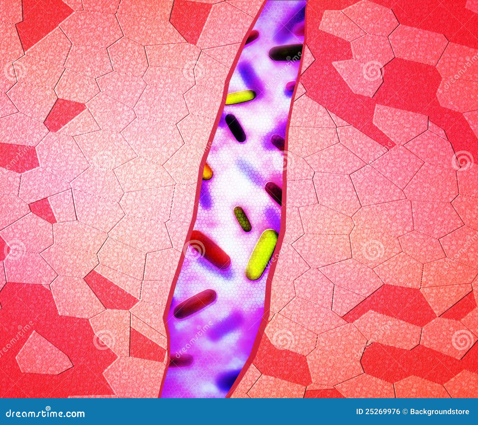 Open Wound stock illustration. Illustration of patient - 25269976