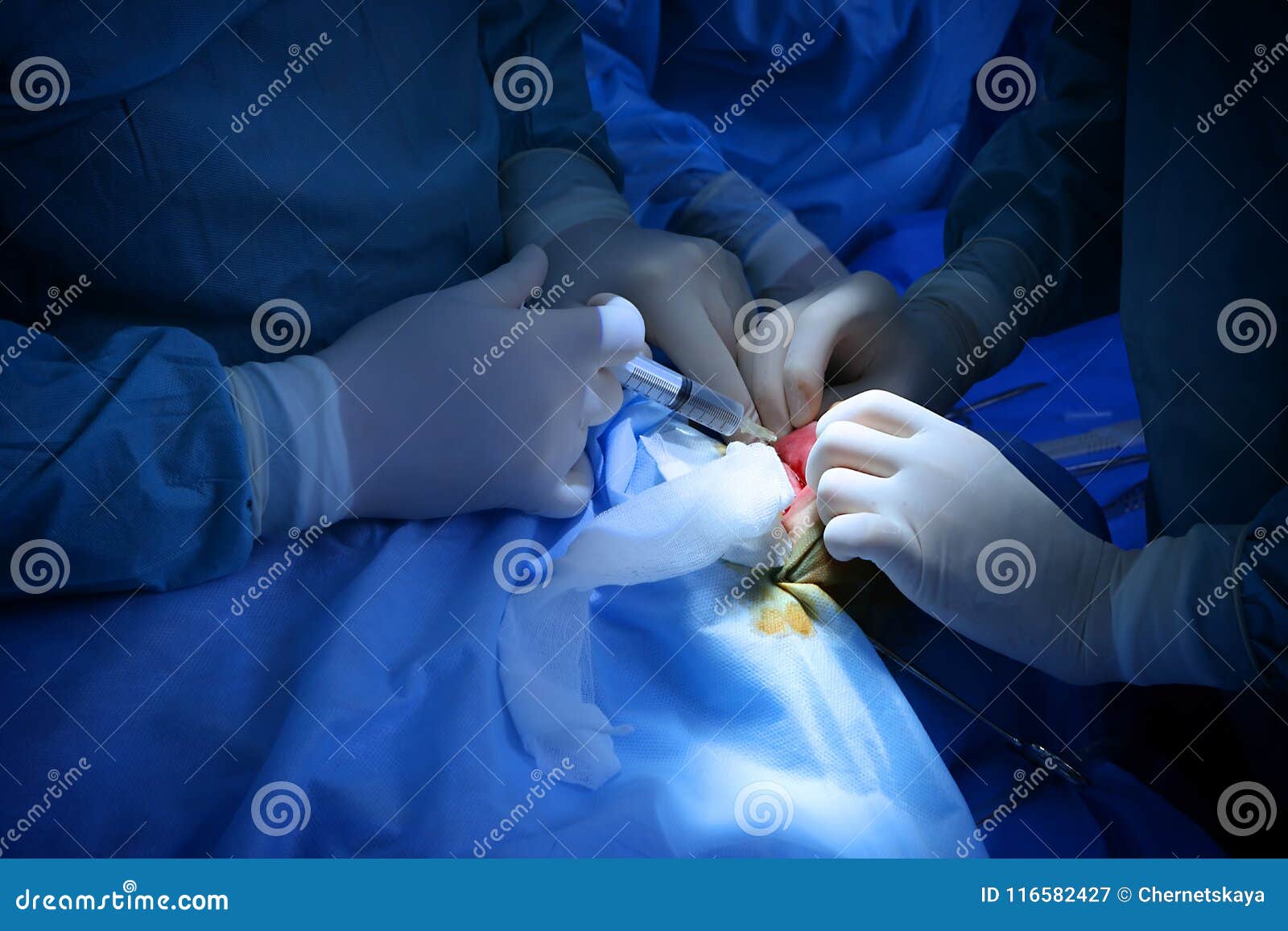 Operating of Patient in Hospital Stock Image - Image of medical, female ...