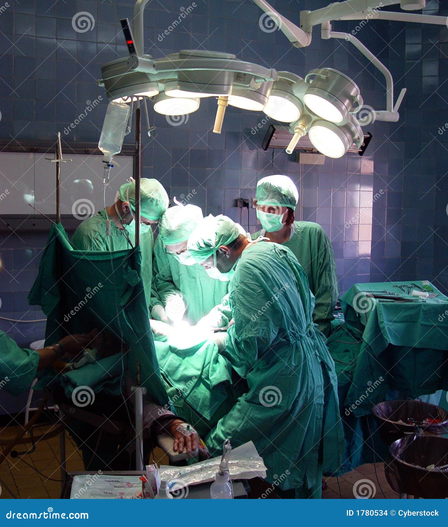 Operation stock photo. Image of hand, operation, hair - 1780534