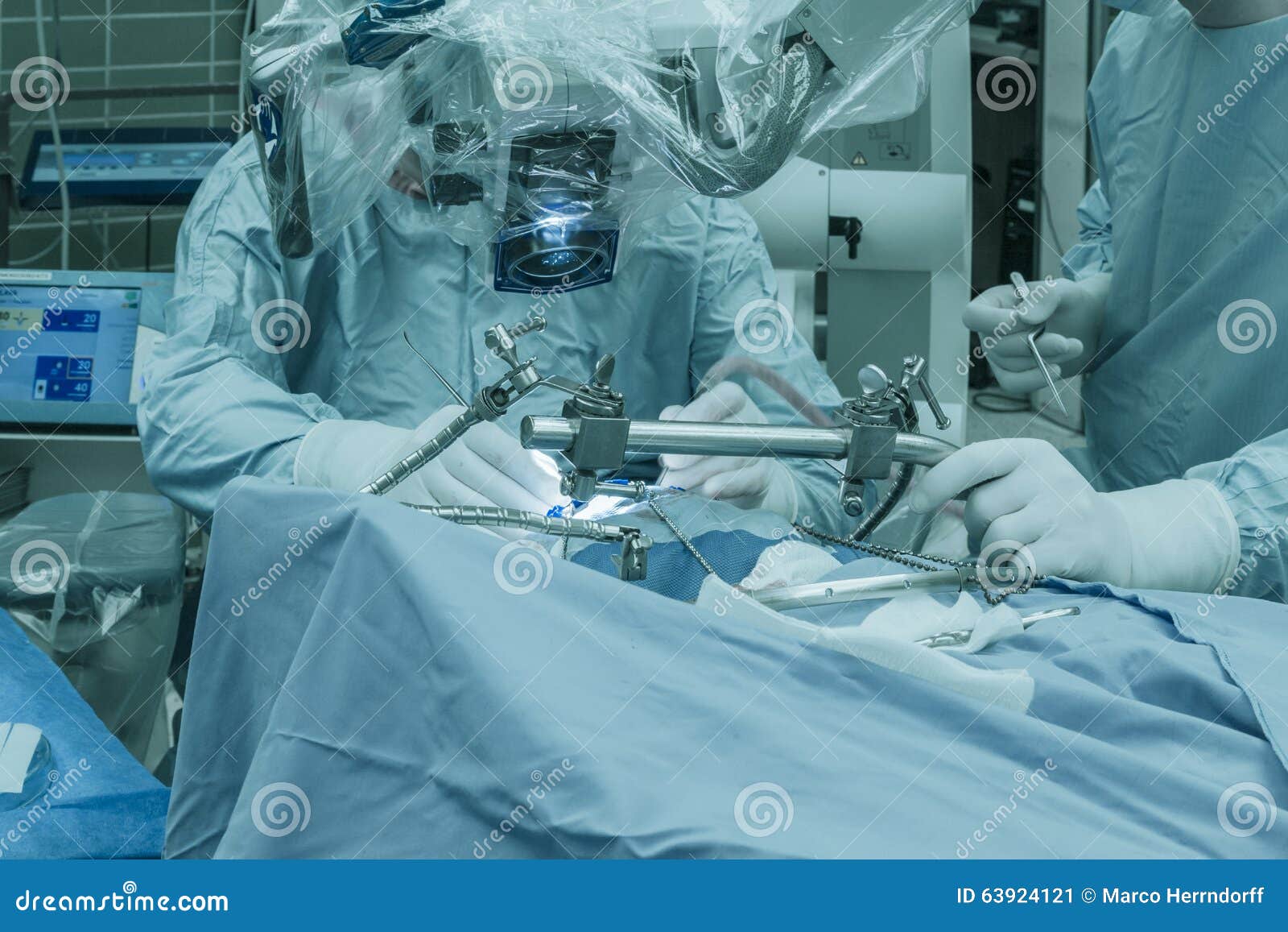 Operation of a brain tumor stock image. Image of room - 63924121
