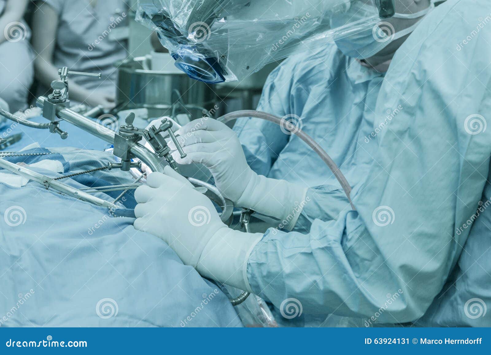 Operation of a brain tumor stock image. Image of blood - 63924131