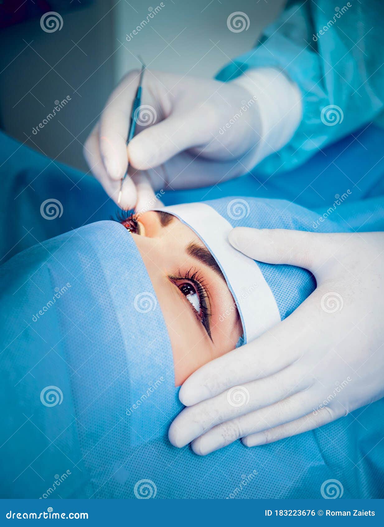 The Operation on the Eye. Cataract Surgery. Stock Photo - Image of ...