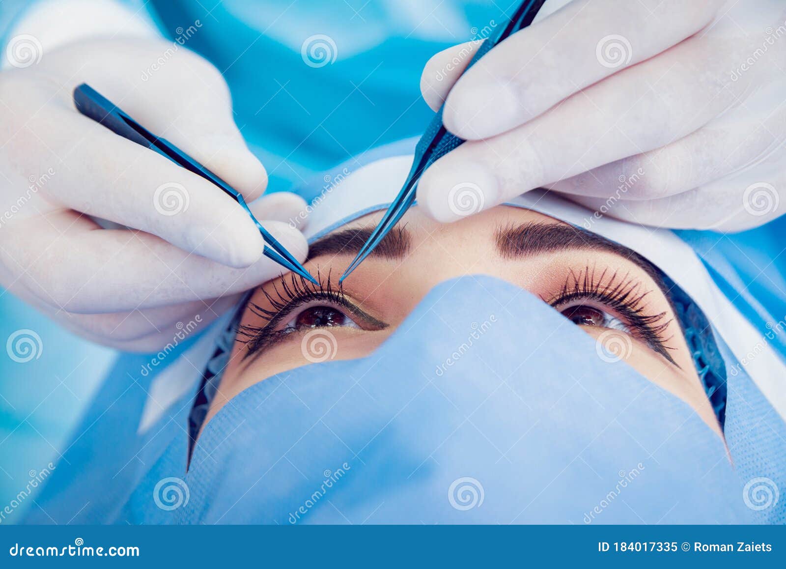 The Operation on the Eye. Cataract Surgery. Stock Image - Image of ...