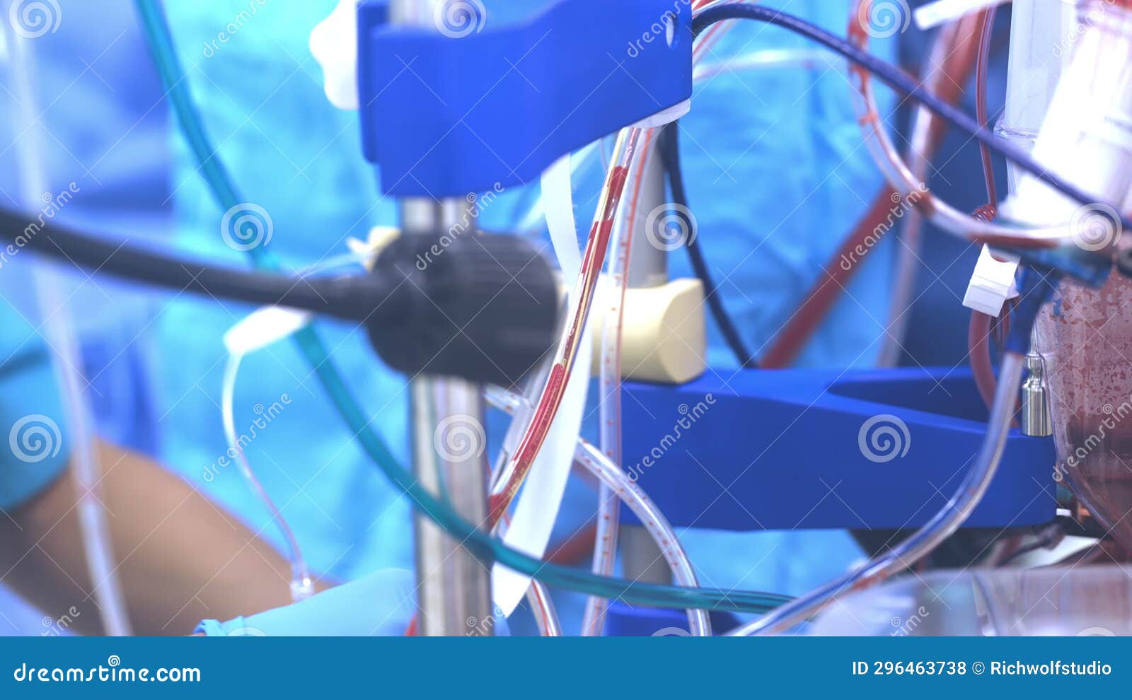 Operation of a Heart-lung Machine in the Operating Room during Heart ...