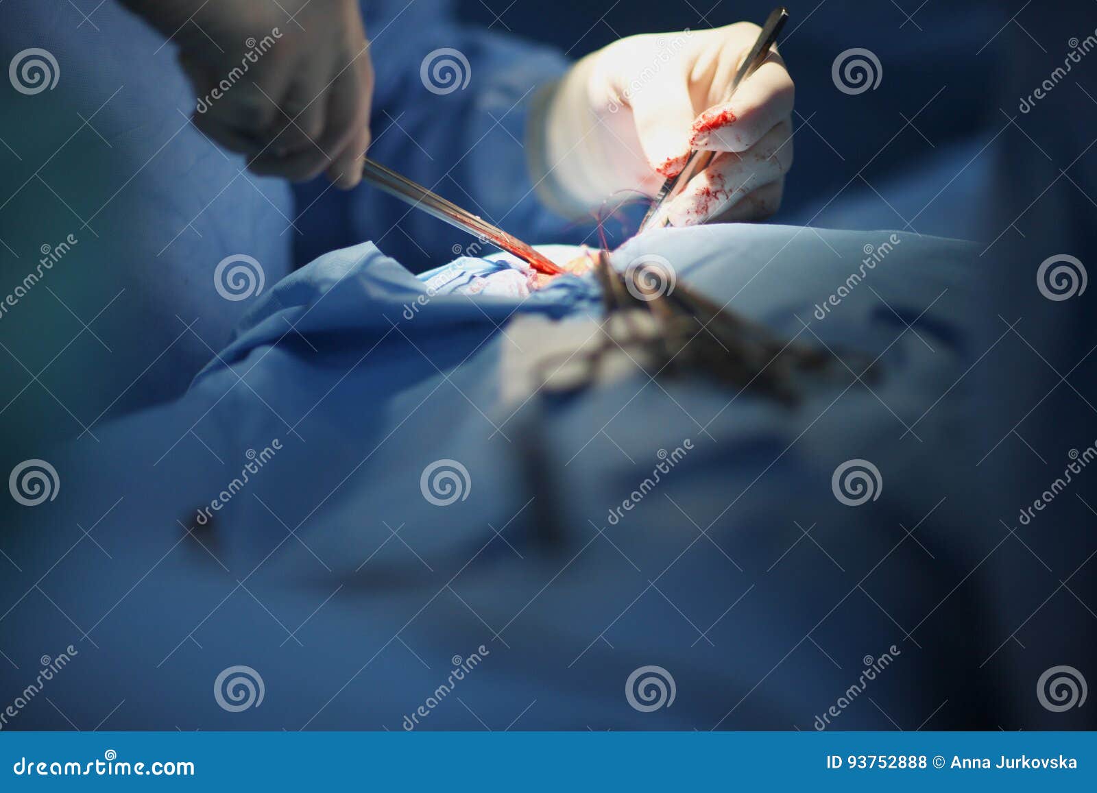 Operation under anesthesia stock photo. Image of indoors - 93752888