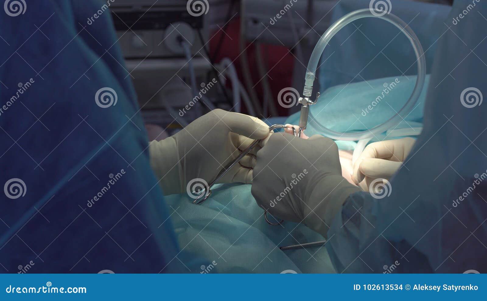 Operation Using Laparoscopic Equipment. Surgeons Team. Hospital. Stock ...