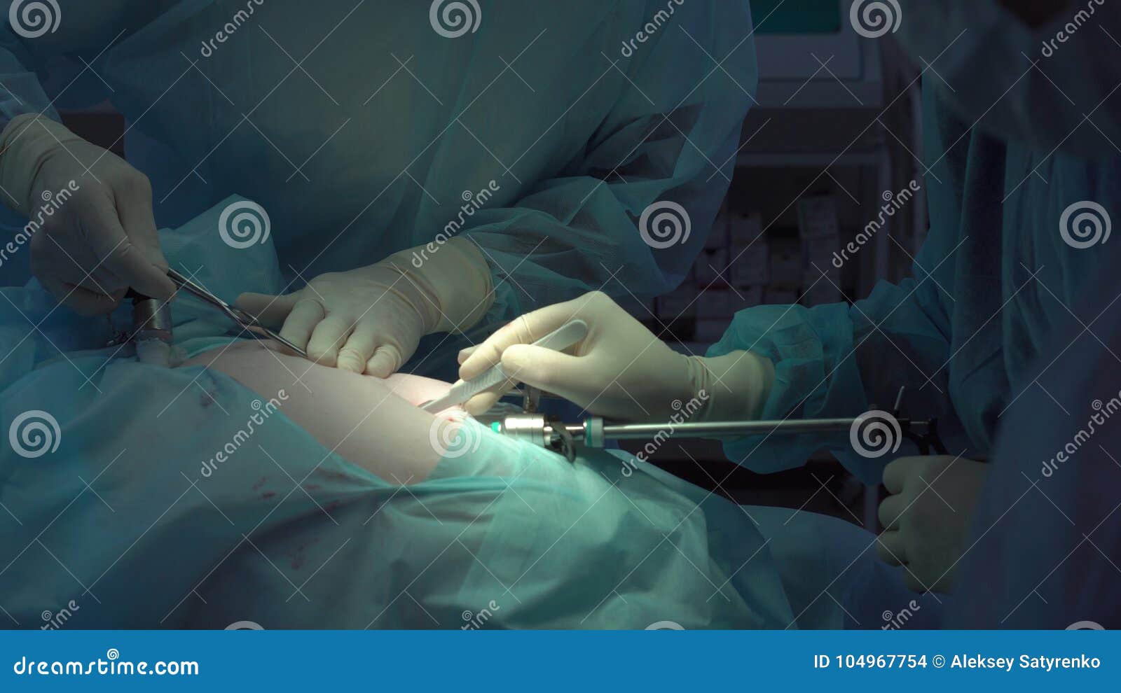 Operation Using Laparoscopic Equipment. Surgeons Team. Hospital. Stock ...