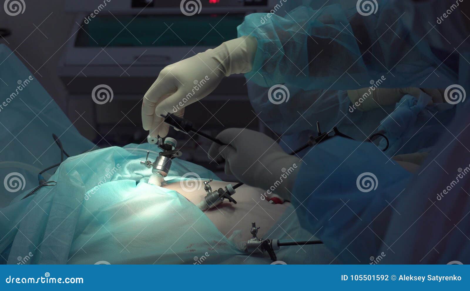 Operation Using Laparoscopic Equipment. Surgeons Team. Hospital. Stock ...