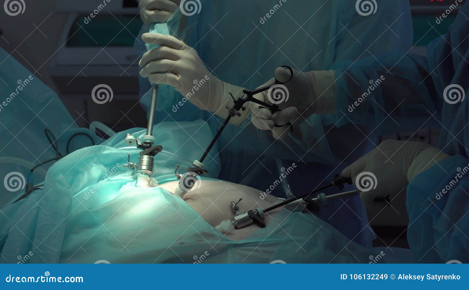 Operation Using Laparoscopic Equipment. Surgeons Team. Hospital. Stock ...
