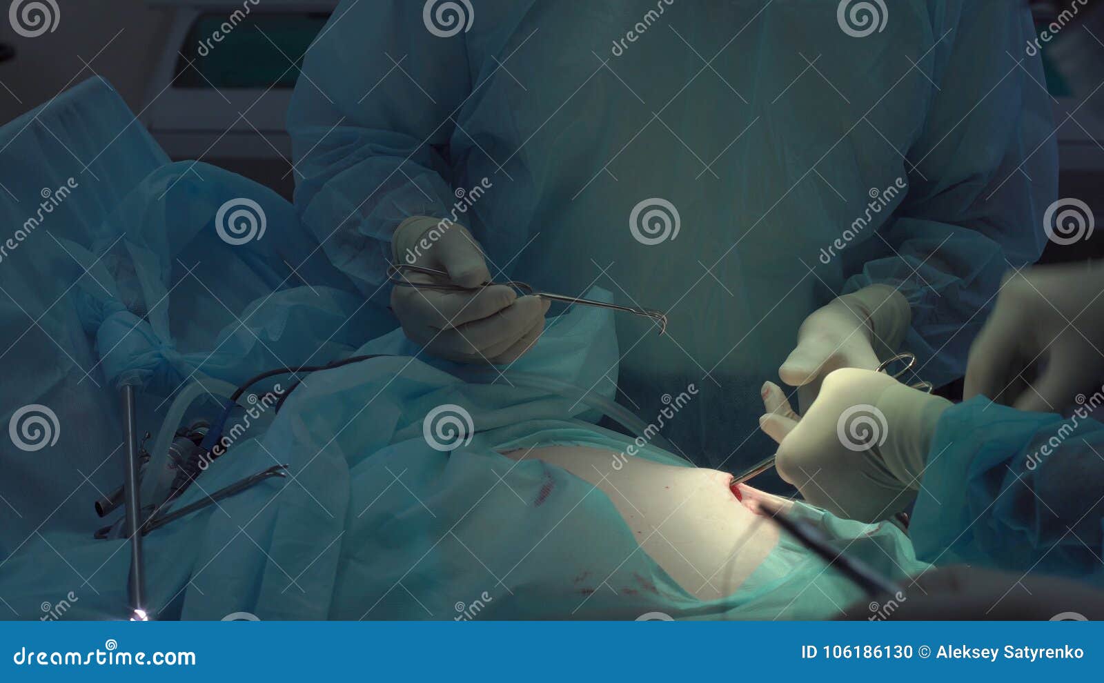 Operation Using Laparoscopic Equipment. Surgeons Team. Hospital. Stock ...