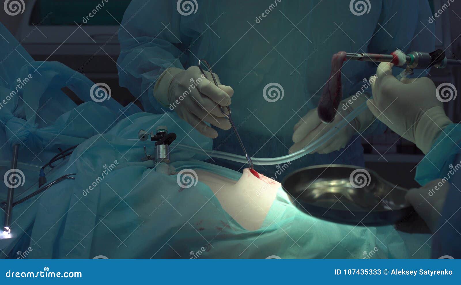 Operation Using Laparoscopic Equipment. Surgeons Team. Hospital. Stock ...