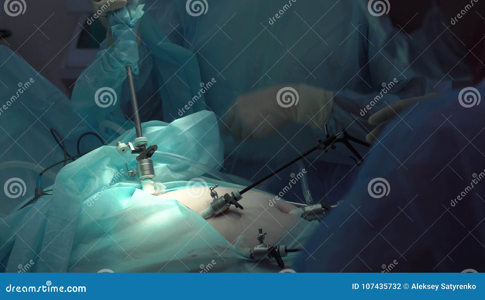 Operation Using Laparoscopic Equipment. Surgeons Team. Hospital. Stock ...