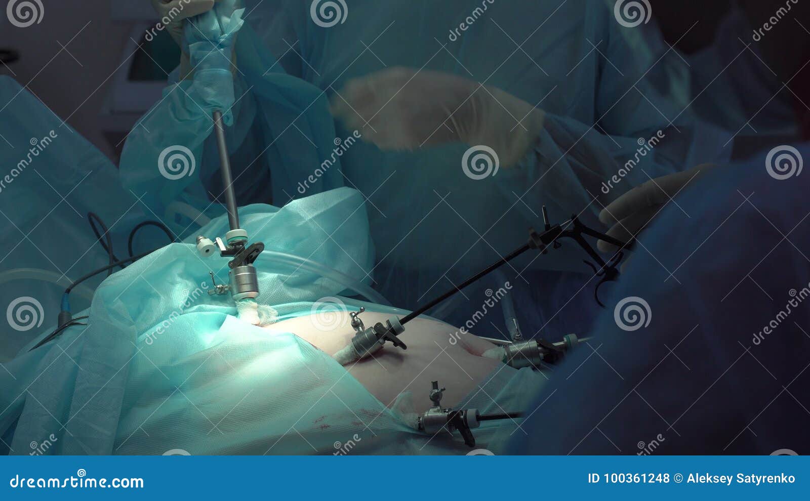 Operation Using Laparoscopic Equipment. Surgeons Team Working with of ...