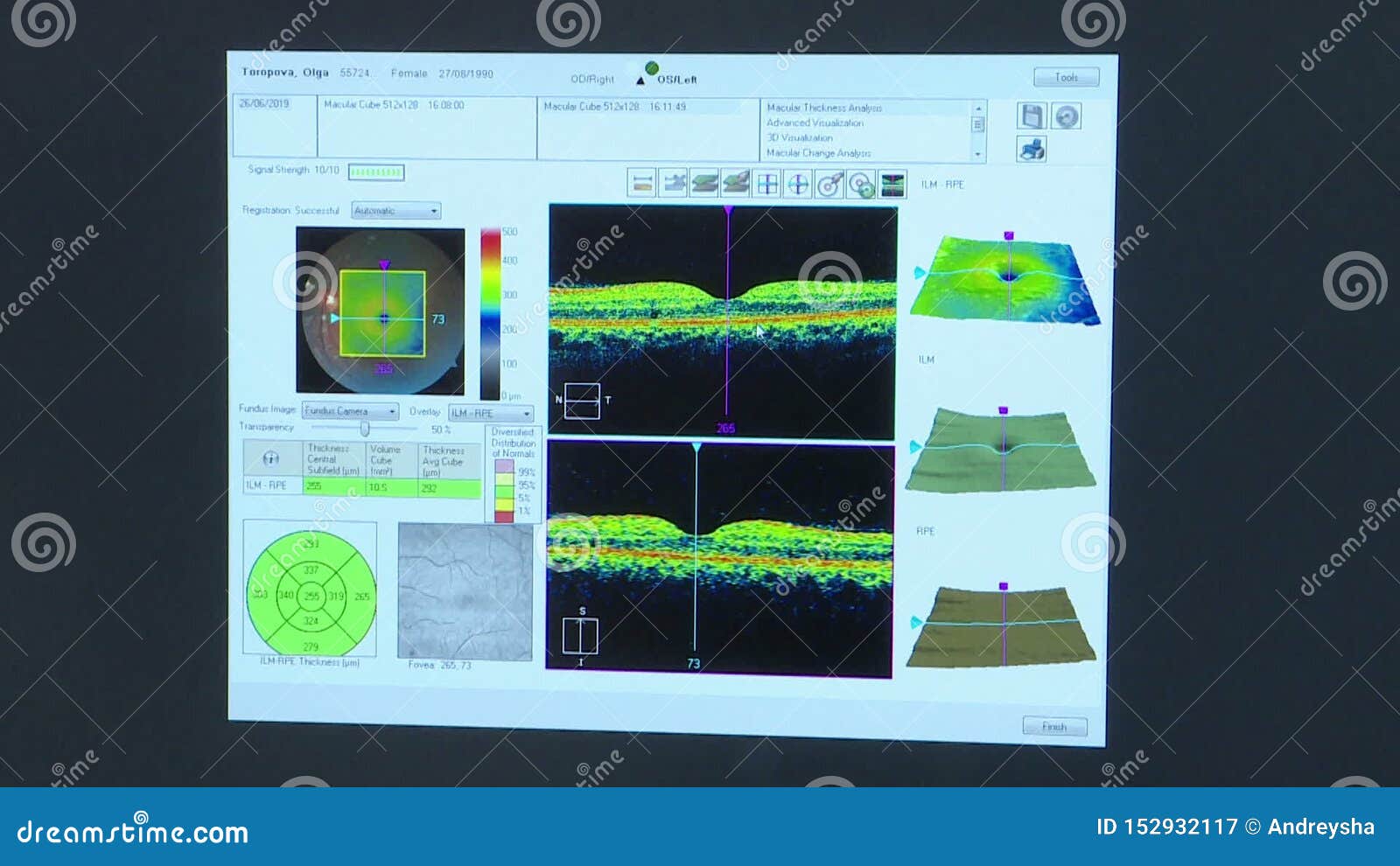 Ophthalmological Examination on a Computer , Eye Health Check and ...