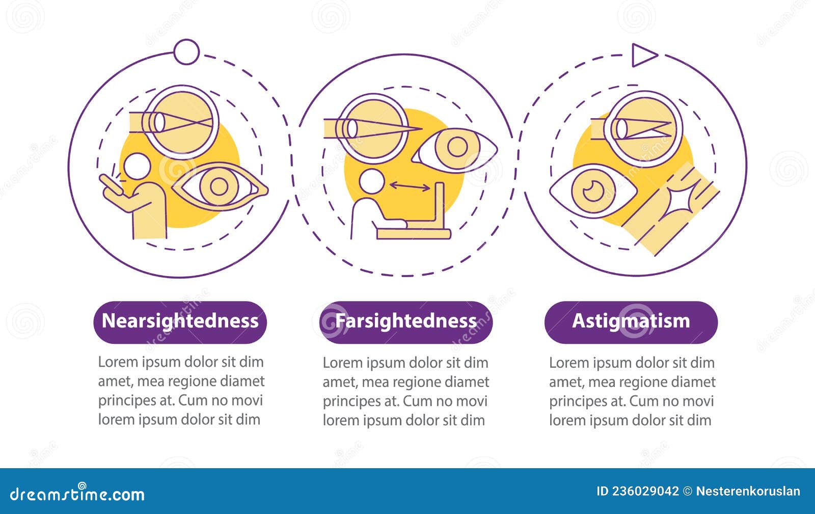 Ophthalmology Vector Infographic Template Stock Vector - Illustration ...