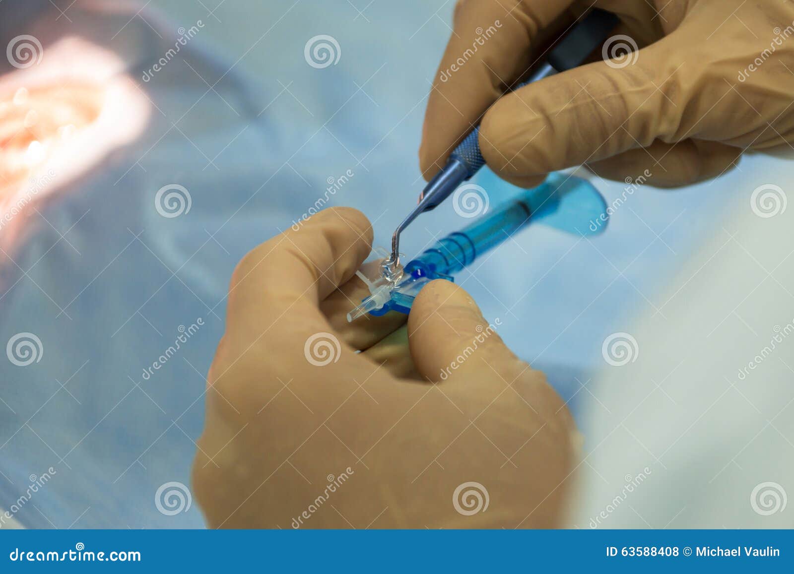 Opthtalmology Cataract Operation Stock Photo - Image of care ...